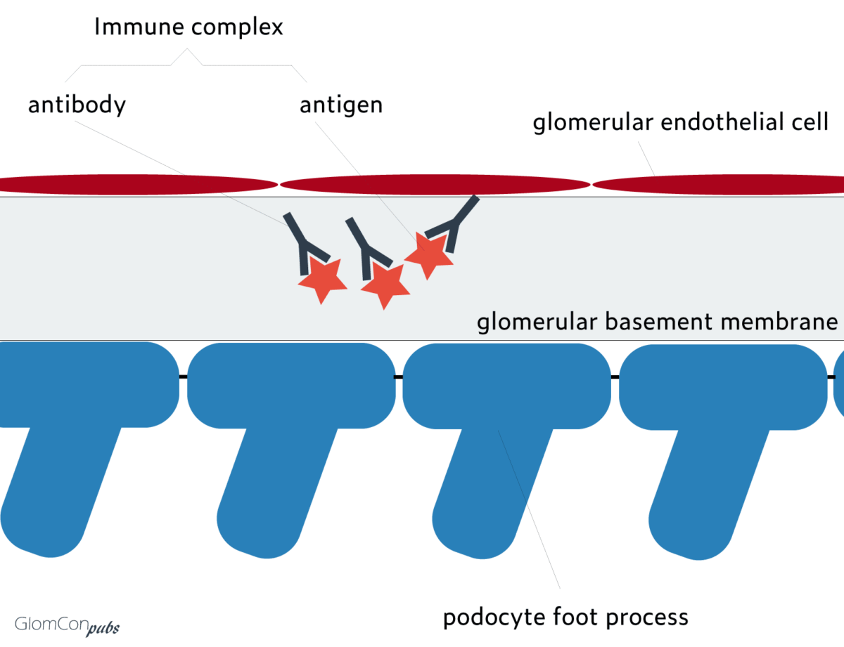 Target Antigens and Noninvasive Markers in Membranous Nephropathy ...