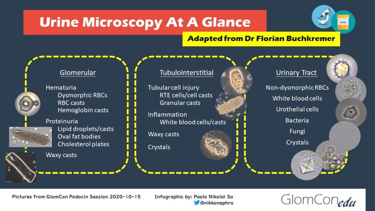 Urine Microscopy Infographic – GlomCon (pubs)
