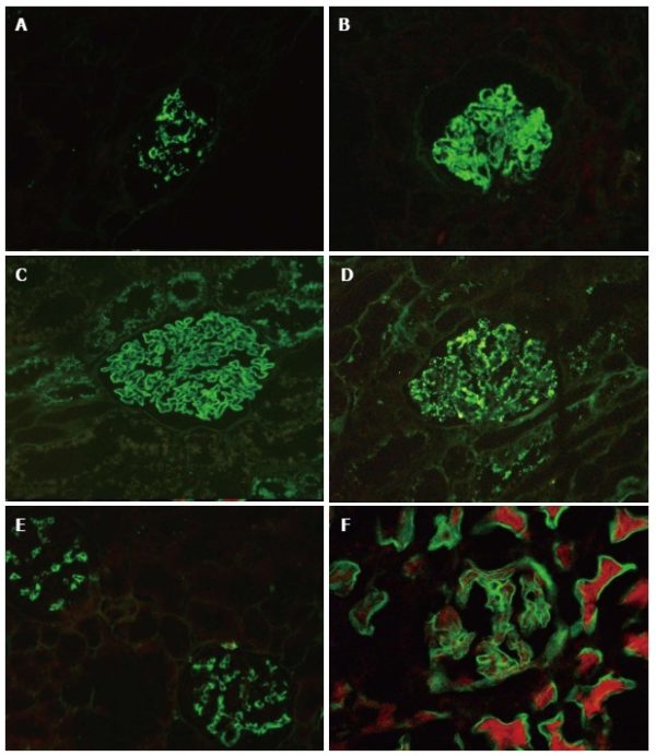 Kidney Biopsy From Needle to Report: The Basics – GlomCon (pubs)