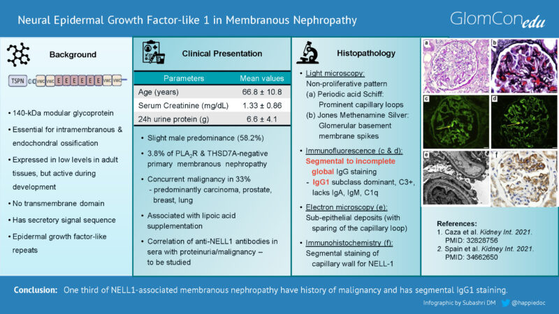 Nerve Epidermal Growth Factor-like 1 (NELL-1) in Membranous Nephropathy ...
