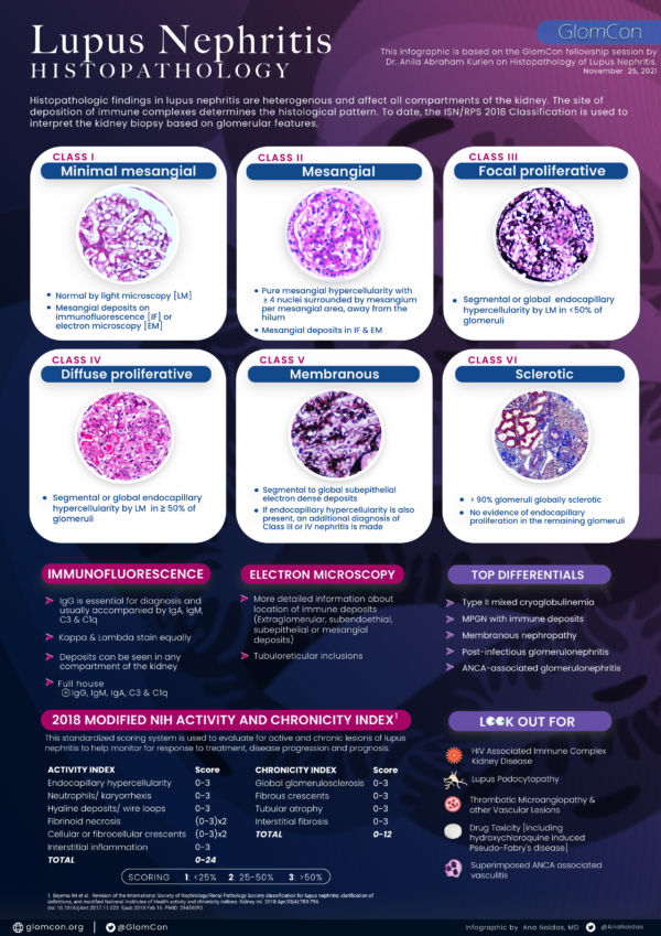 Lupus Nephritis Pathophysiology and Histopathology Infographics ...